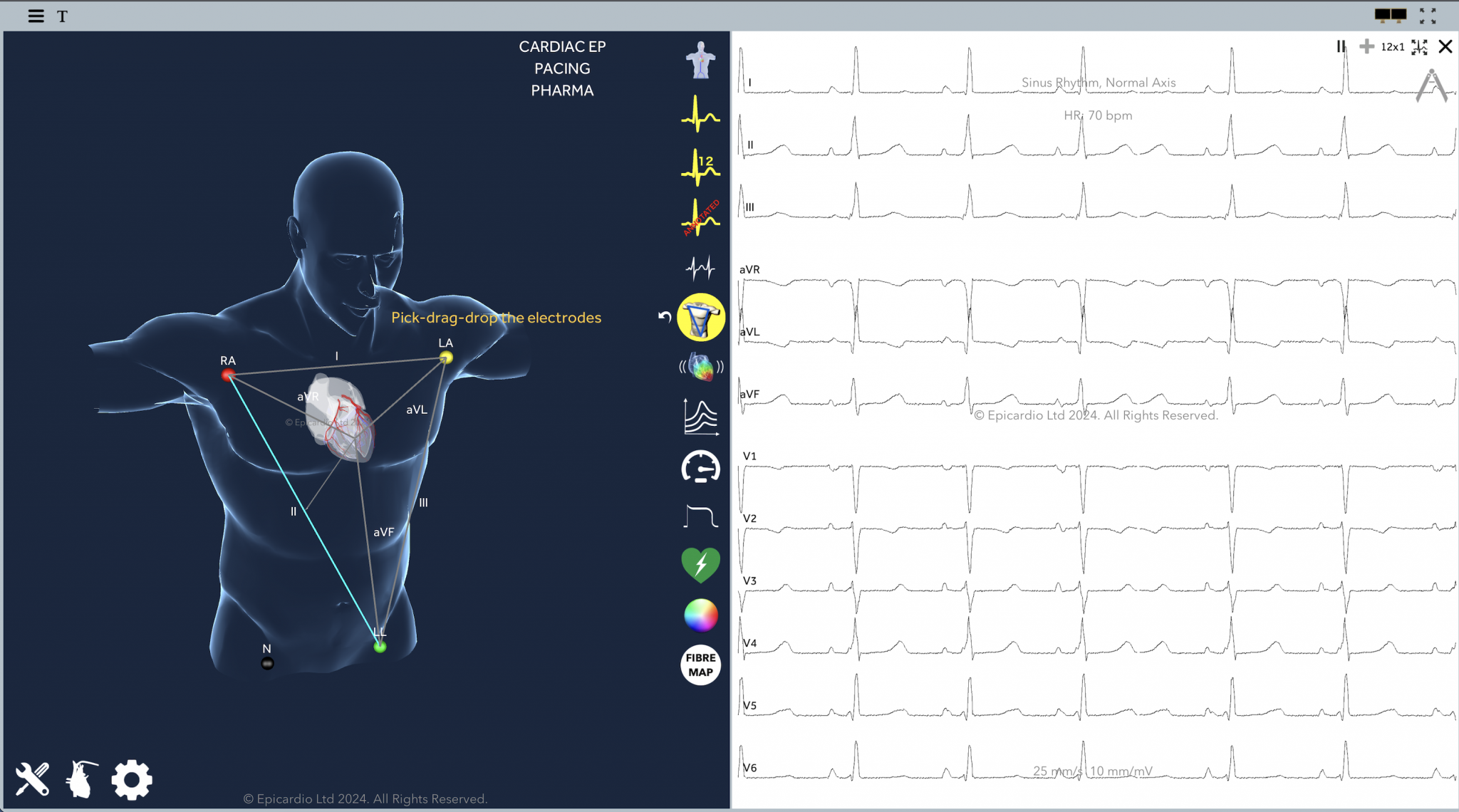 ECG/EP Simulation for Medical Students | Learn Cardiology Online